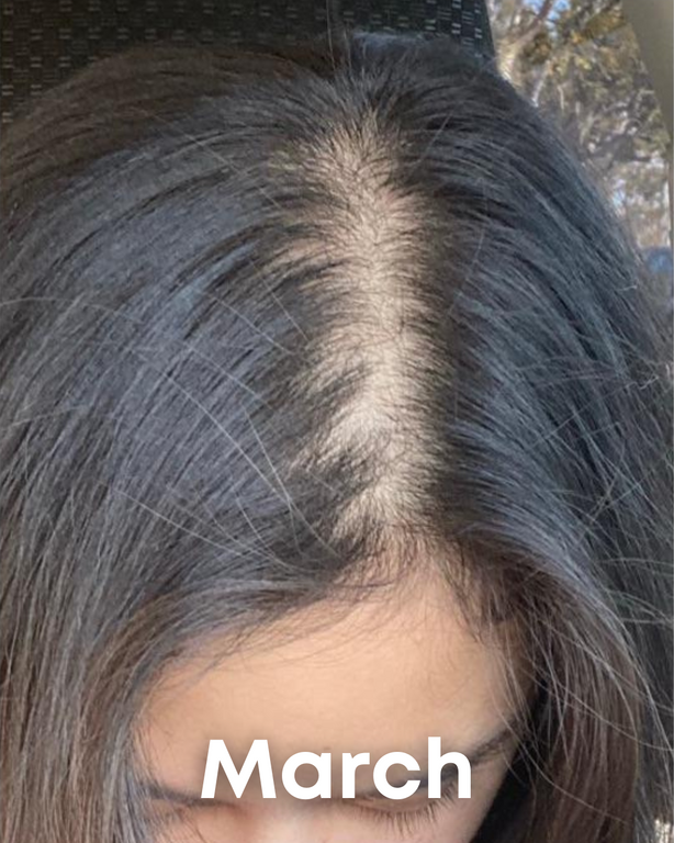 Alments™ HairRevive - Healthier & Thicker Hair